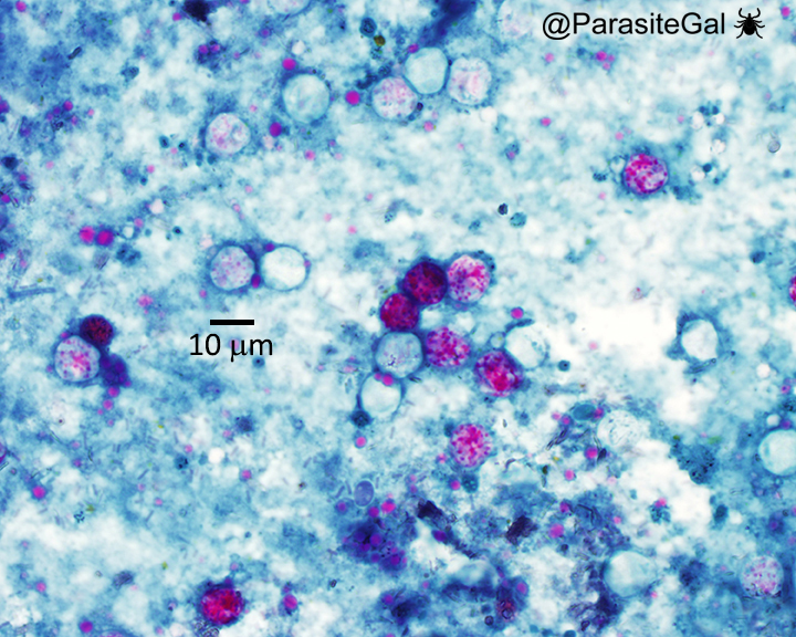 Cyclospora Cayetanensis Oocysts